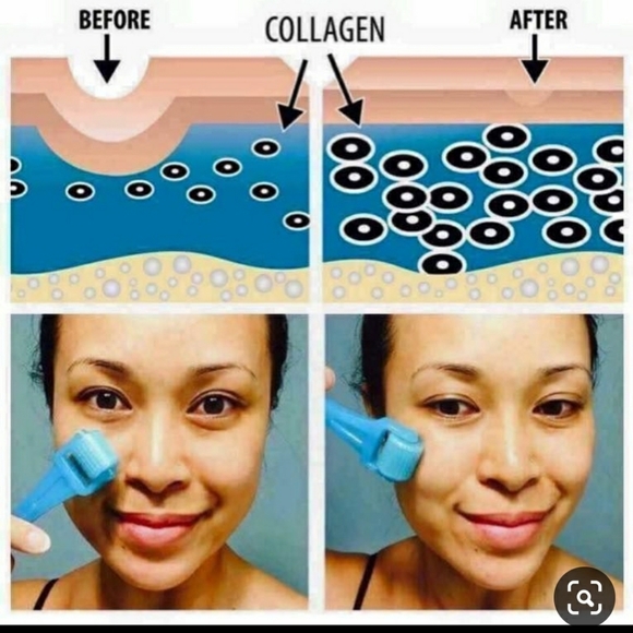Rodan + Fields | Makeup | New Rodan And Fields Amp Md Roller | Poshmark